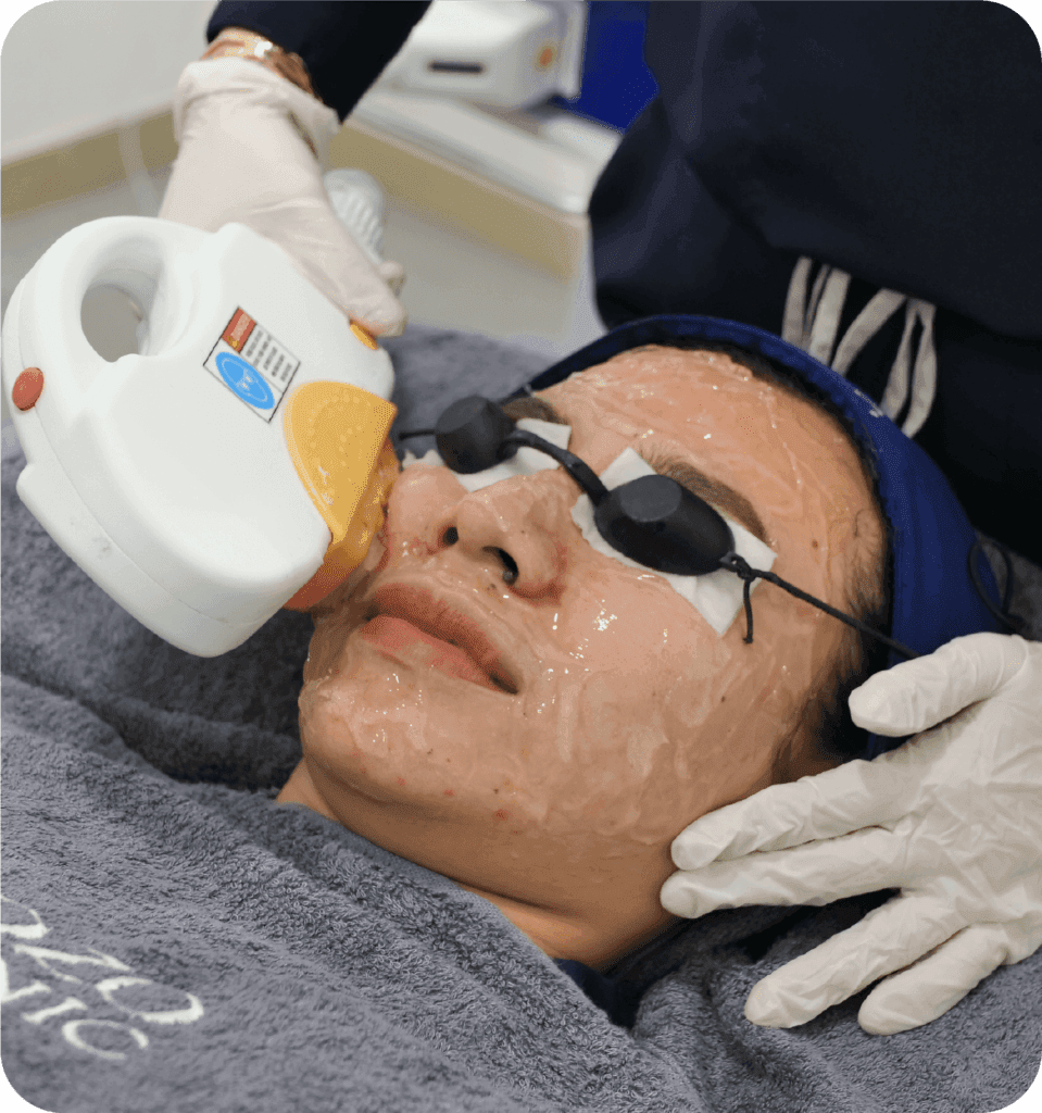 IPL Treatment: IPL Glow, IPL Acne, Manfaat dan Keunggulannya